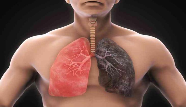 More than 1 in 10 people with lung diseases could be sick due to ...