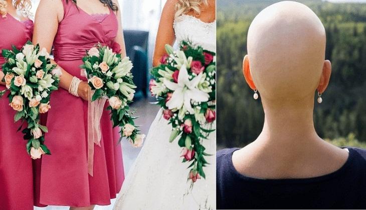Bride goes bald just before her wedding; know bizarre reason | Catch News